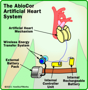 artificial-heart-abiocor-diagram – عالم الالكترون